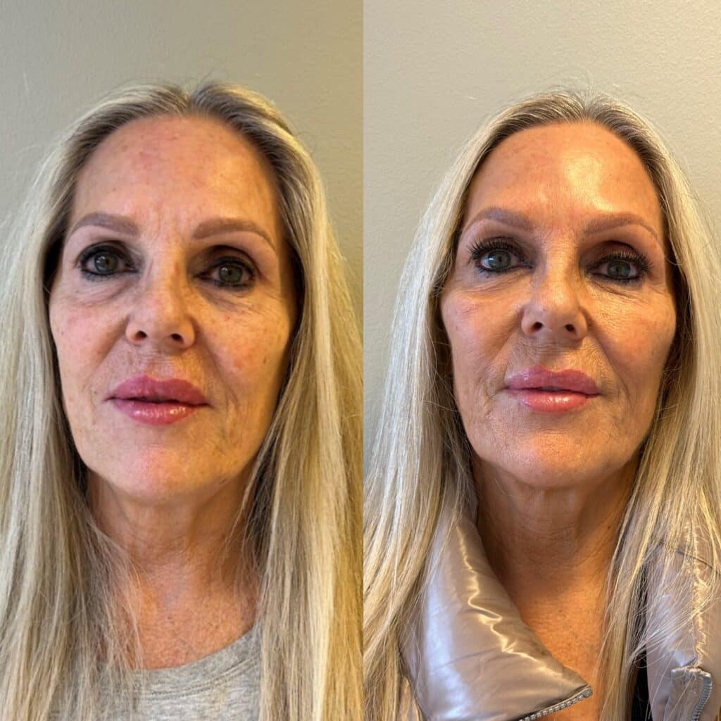 Sunekos - Perfection By Toft